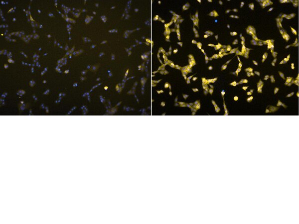 MAPK Pathway 1 Explorer Antibody MiniPack | 15-107